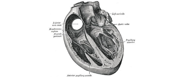 A mildly dilated right atrium - Mamilian